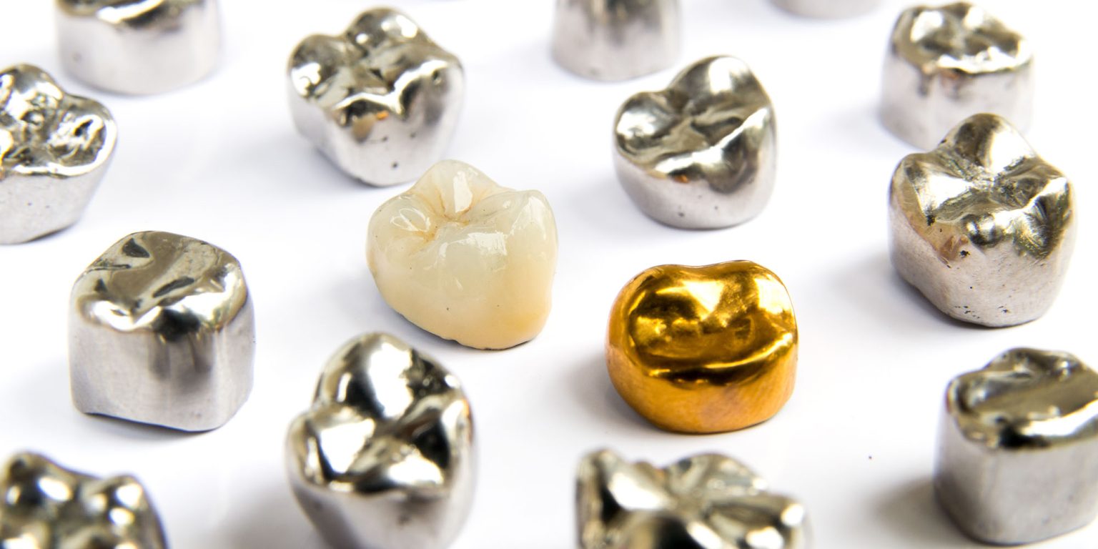 Do You Need A Dental Crown? Fix Broken Teeth At Lister House, Essex